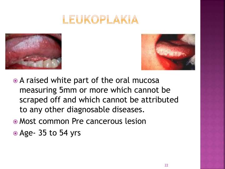 PPT - EPIDEMIOLOGY, ETIOLOGY AND PREVENTION OF ORAL CANCER PowerPoint ...