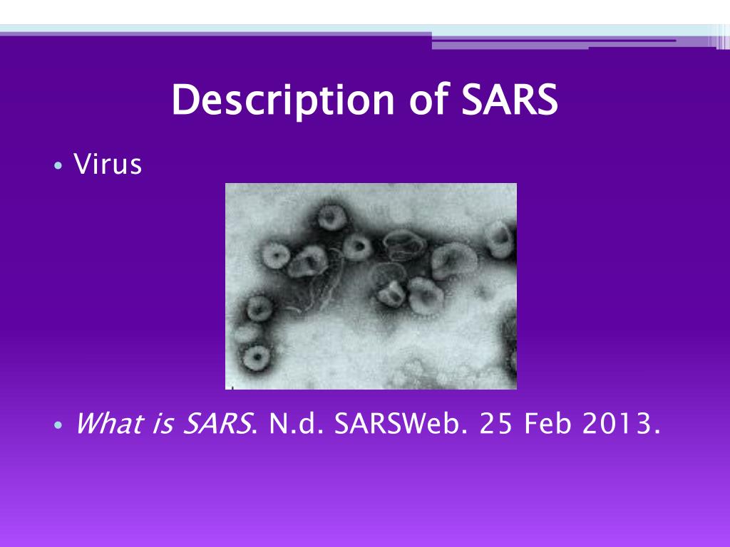 PPT - Severe Acute Respiratory Syndrome (SARS) PowerPoint Presentation ...
