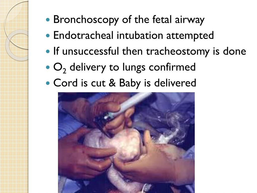 PPT - ANAESTHESIA FOR INTRAUTERINE FETAL SURGERY PowerPoint ...