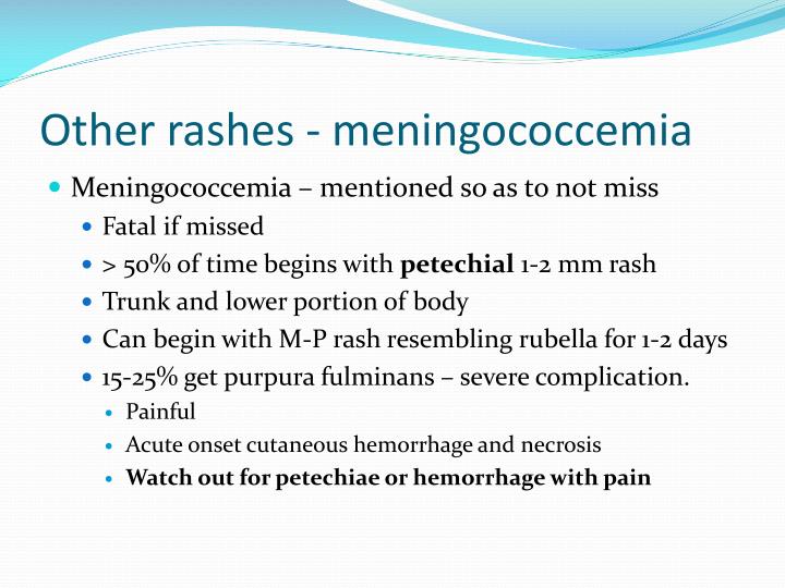 PPT - Measles and Other Childhood Exanthems PowerPoint Presentation ...