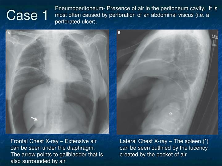PPT - Abdominal Imaging PowerPoint Presentation - ID:2275884