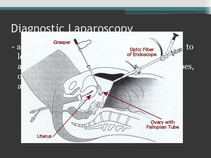 PPT - Diagnostic Laparoscopy PowerPoint Presentation - ID:2275901