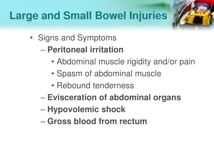 PPT - Abdominal Trauma PowerPoint Presentation - ID:2275990