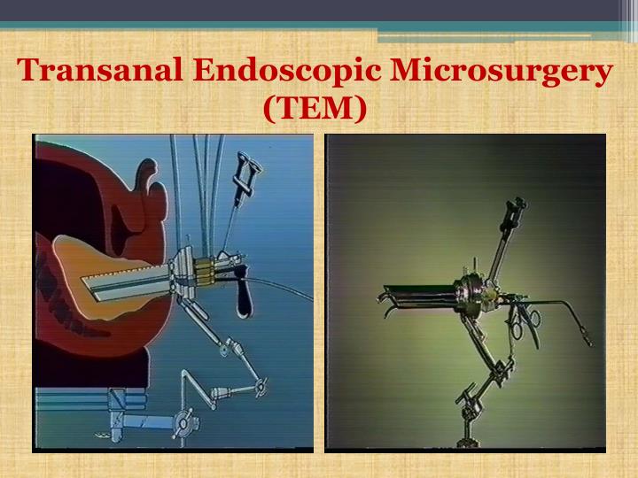 PPT - Rectal cancer PowerPoint Presentation - ID:2276176