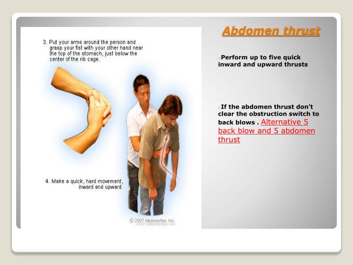 PPT - Conscious/unconscious choking adult PowerPoint Presentation - ID ...