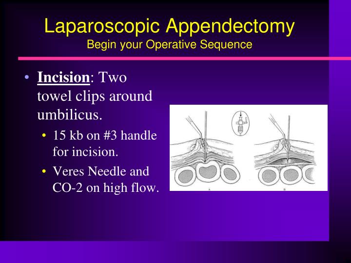 PPT - General Procedures PowerPoint Presentation - ID:2277339