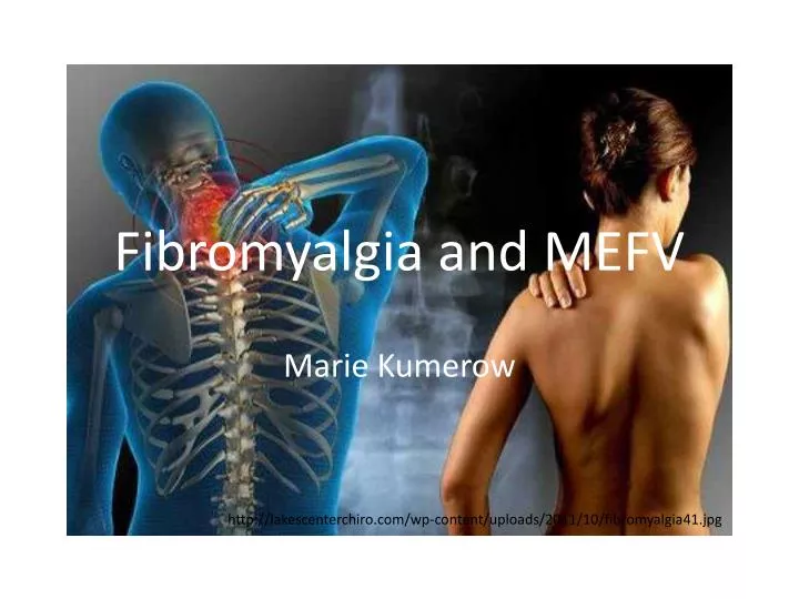 PPT - Fibromyalgia and MEFV PowerPoint Presentation, free download - ID ...