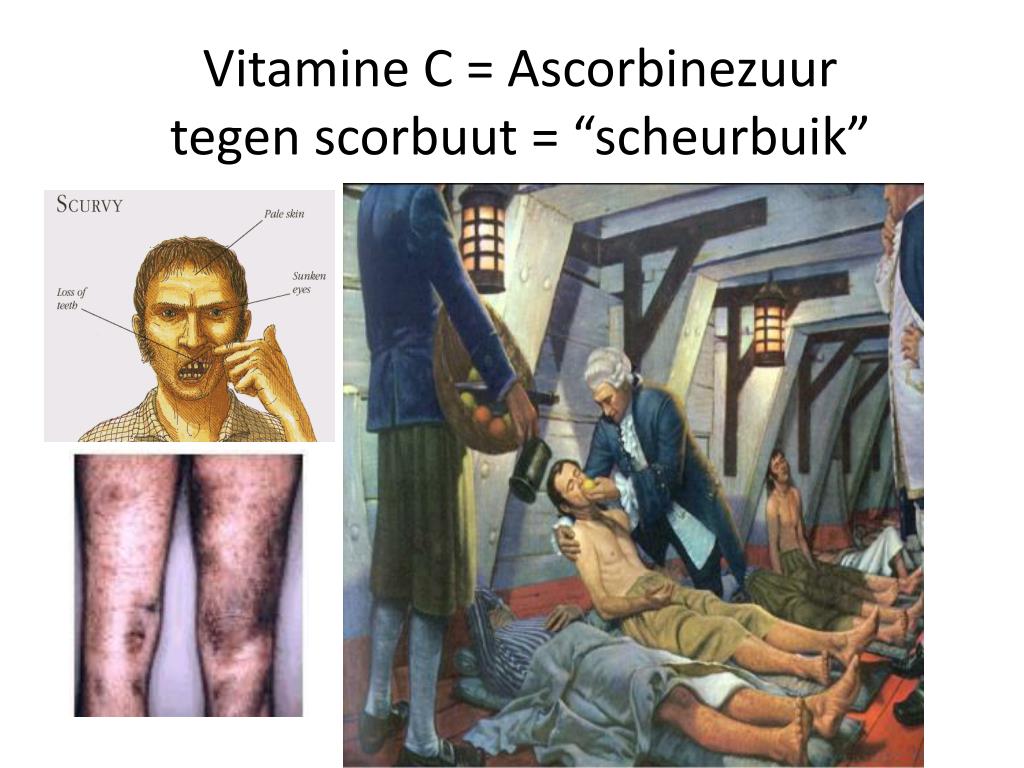 PPT - Gebrekziektes door tekort aan vitamines en mineralen PowerPoint ...