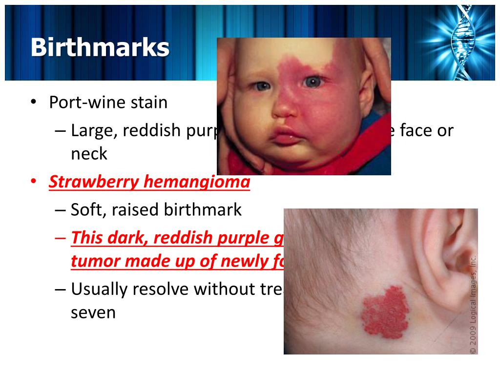 PPT - Pathology & Treatments of the Skin PowerPoint Presentation - ID ...