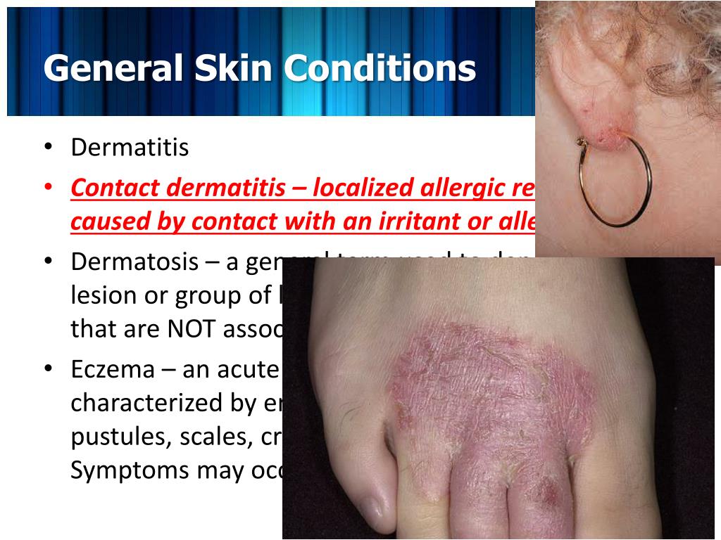 PPT - Pathology & Treatments of the Skin PowerPoint Presentation - ID ...