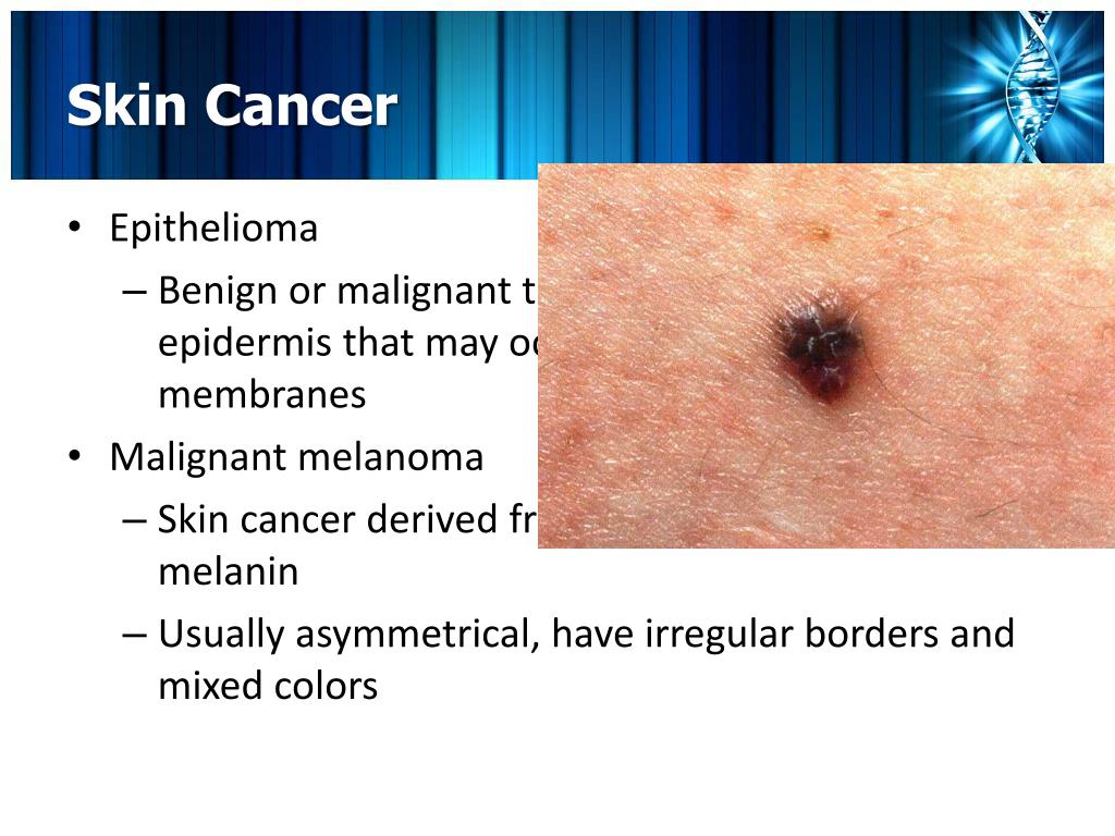 PPT - Pathology & Treatments of the Skin PowerPoint Presentation - ID ...