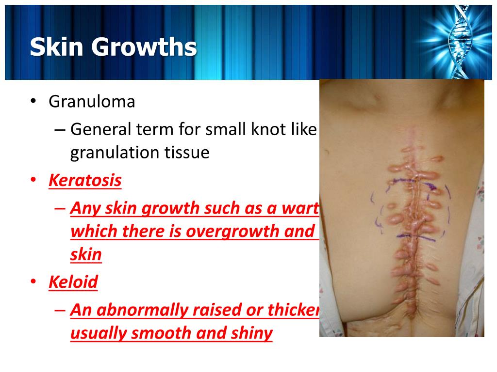 PPT - Pathology & Treatments of the Skin PowerPoint Presentation - ID ...