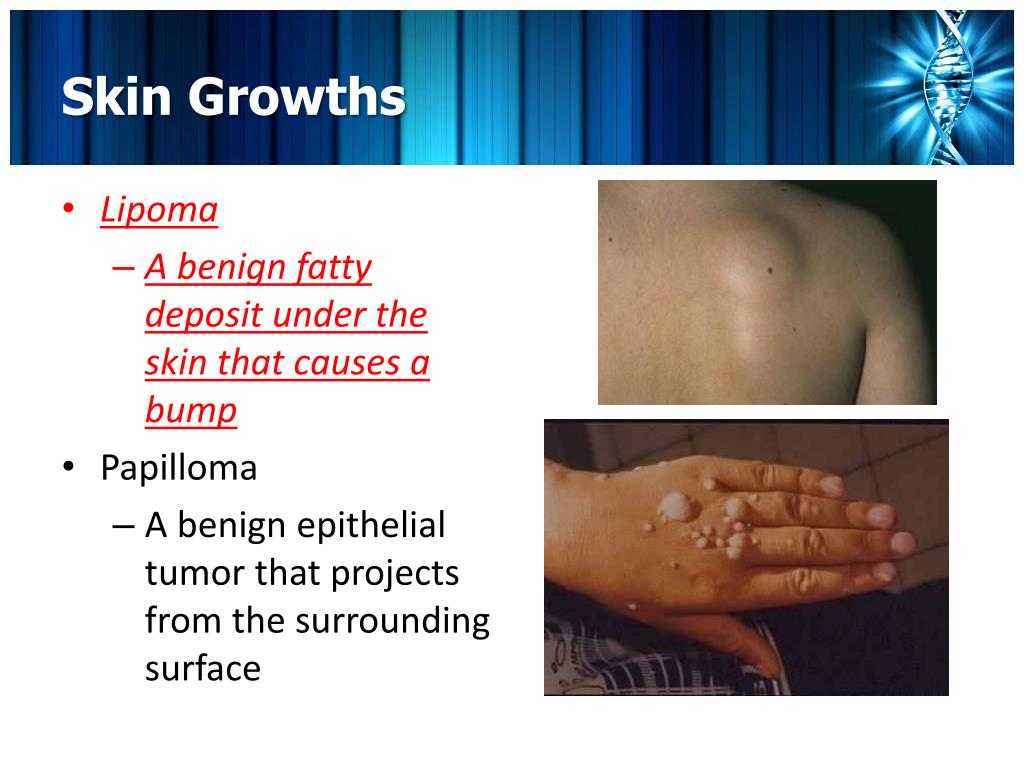 PPT - Pathology & Treatments of the Skin PowerPoint Presentation - ID ...