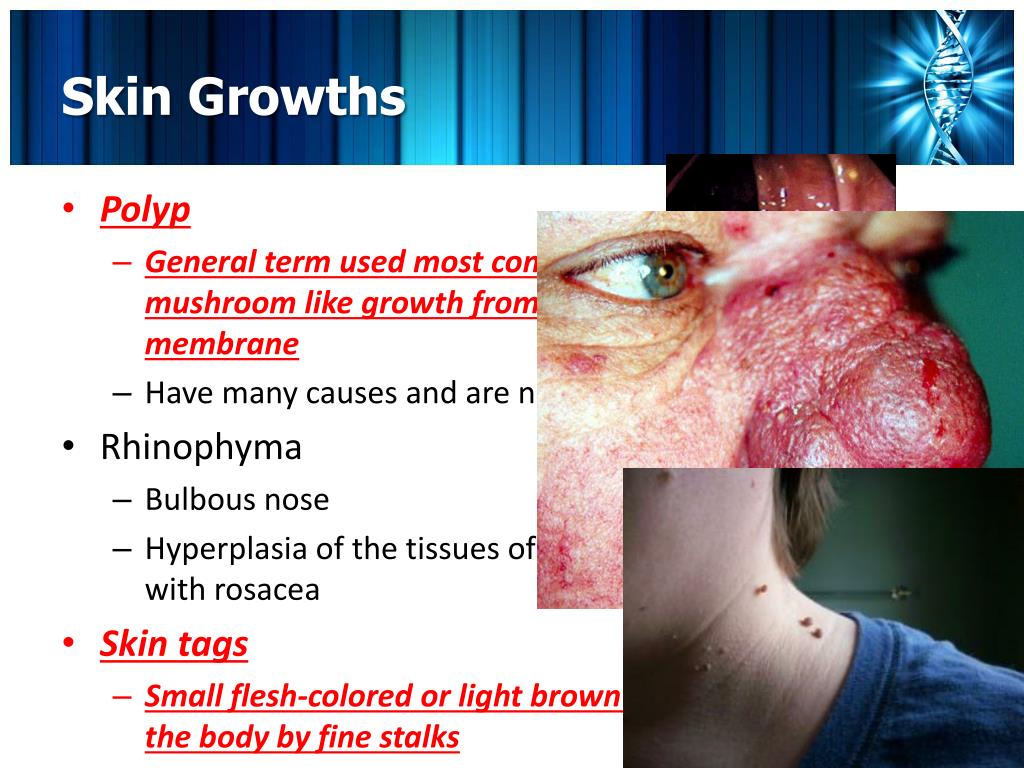 PPT - Pathology & Treatments of the Skin PowerPoint Presentation - ID ...