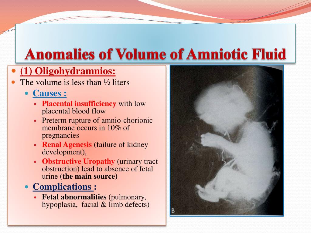 Ppt Fetal Membranes Powerpoint Presentation Free Download Id 2278096
