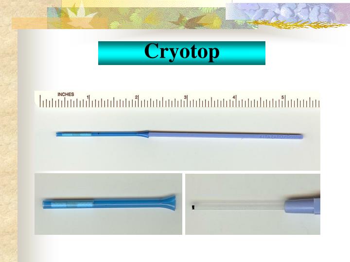 PPT - Vitrification in ART PowerPoint Presentation - ID:2278346