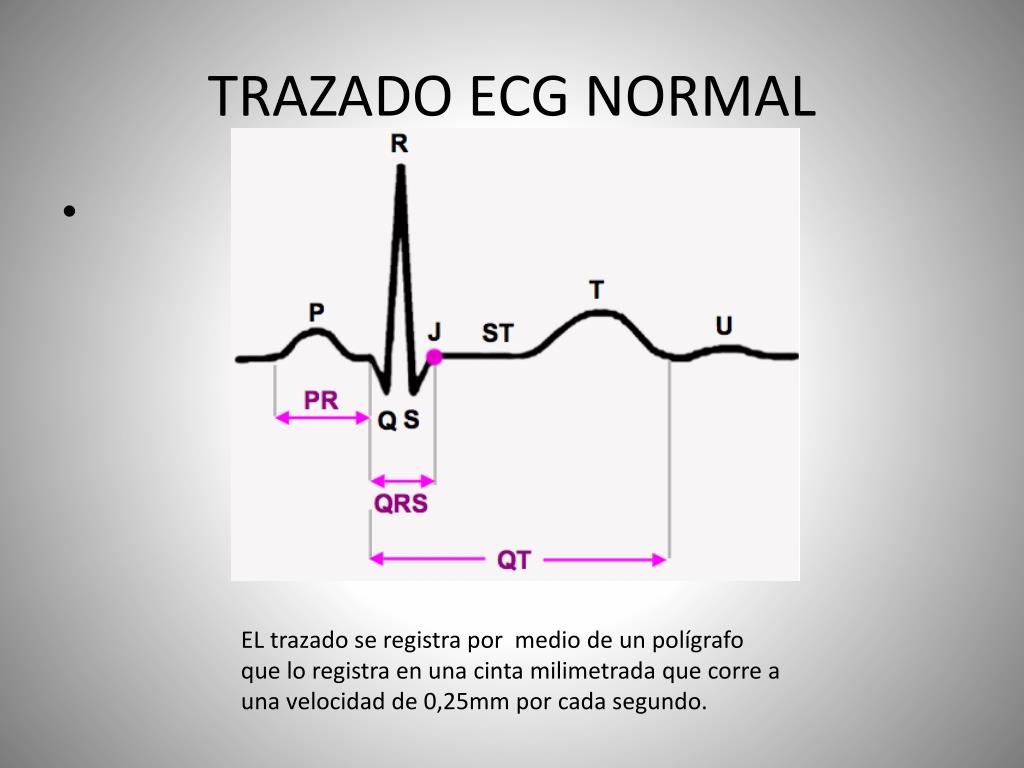 PPT - APUNTES BÁSICOS DE ELECTROCARDIOGRAFÍA PowerPoint Presentation ...