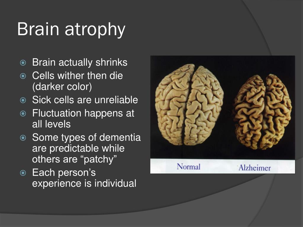 PPT - Dementia Care for America’s Heroes Part 3: Recognizing changes ...