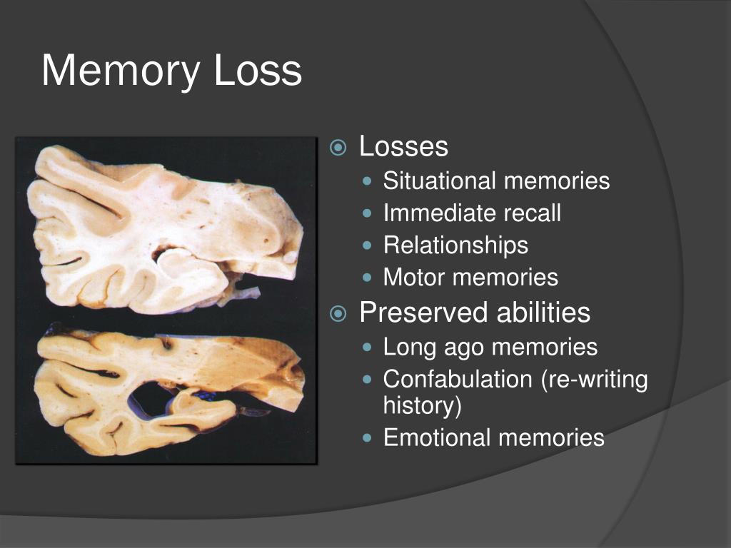 PPT - Dementia Care for America’s Heroes Part 3: Recognizing changes ...