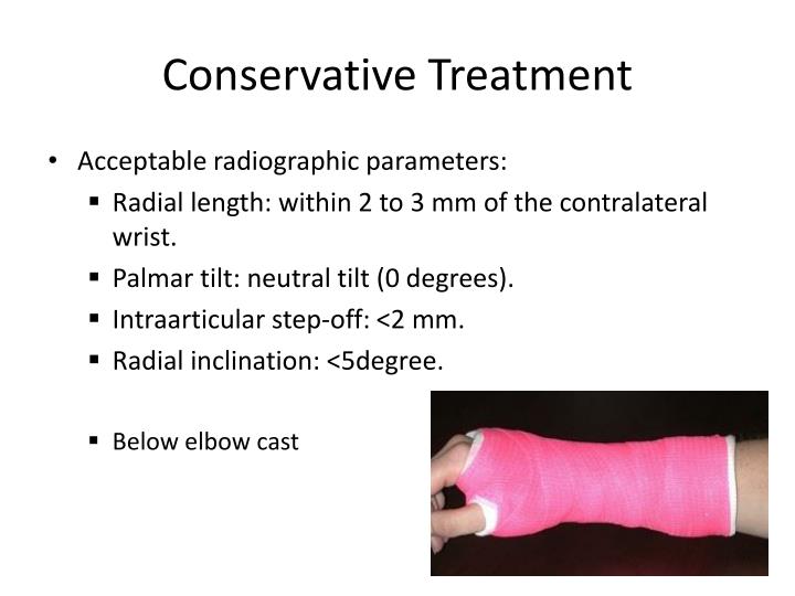 PPT - Common Adult Fractures PowerPoint Presentation - ID:2280629