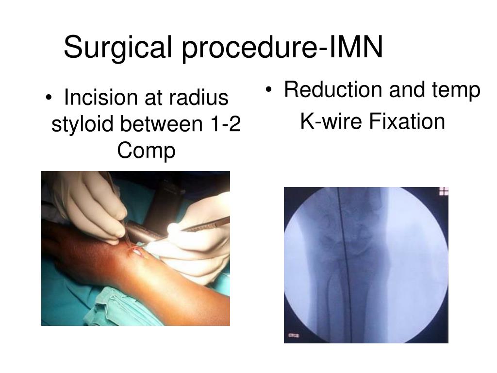 PPT - Mark VanDer Kaag 1 , Ajmal Ikram 2 1 Orthopaedic Registrar ...