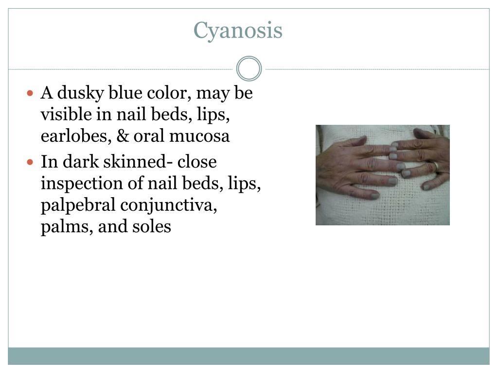 PPT - NRS 103 Skin, Hair, and Nails Chapter 9 PowerPoint Presentation ...