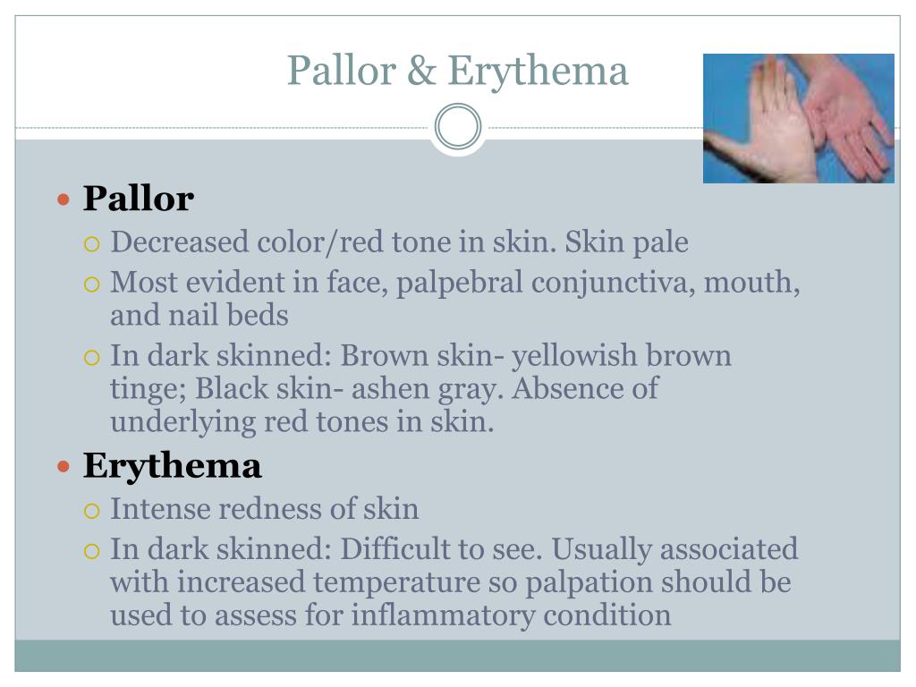 PPT - NRS 103 Skin, Hair, and Nails Chapter 9 PowerPoint Presentation ...