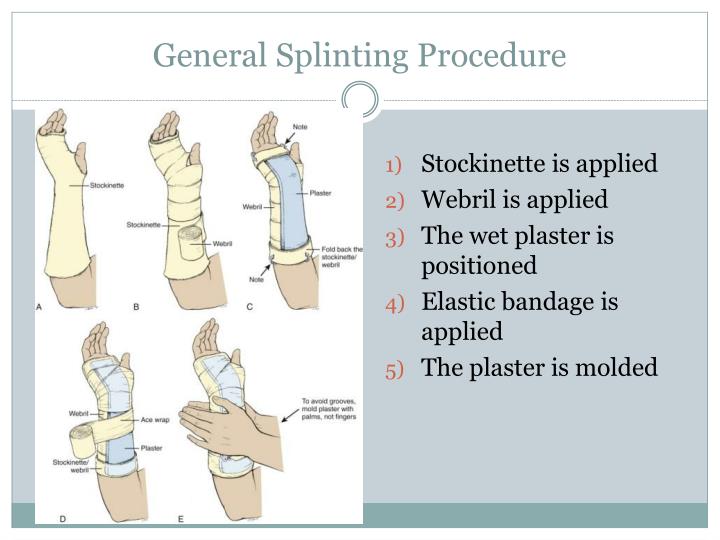 PPT - Procedures: Splinting PowerPoint Presentation - ID:2280962