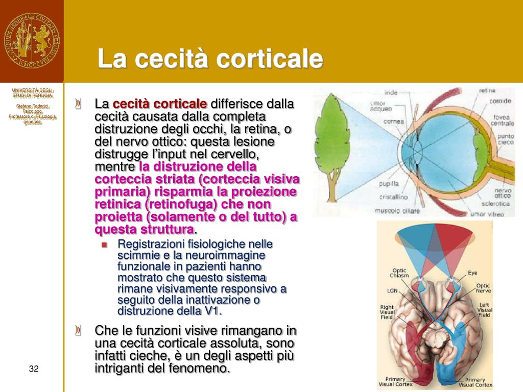 PPT - Corso 3 – Introduzione alle Neuroscienze: La lateralizzazione ...