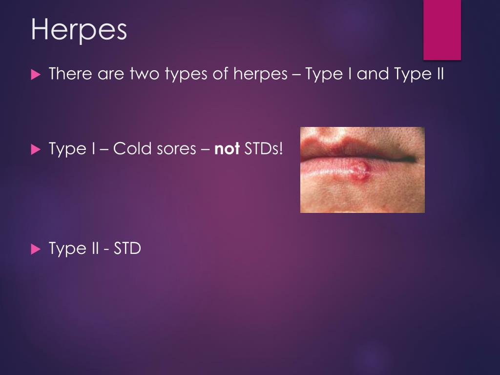 PPT - Sexually Transmitted Diseases and HIV/AIDS PowerPoint ...