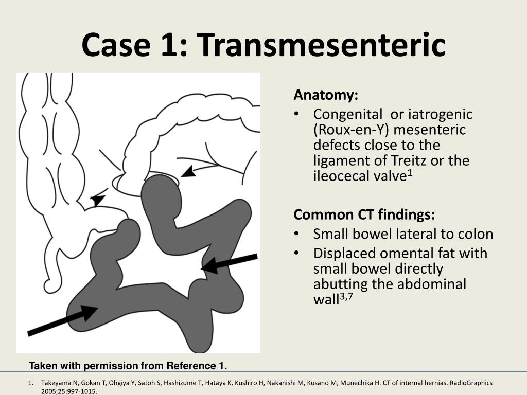 PPT - MDCT Evaluation of Peritoneal and Mesenteric Anatomy: A Pictoral ...