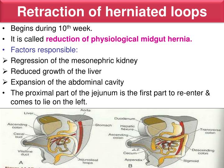 PPT - Development of Midgut PowerPoint Presentation - ID:2282482