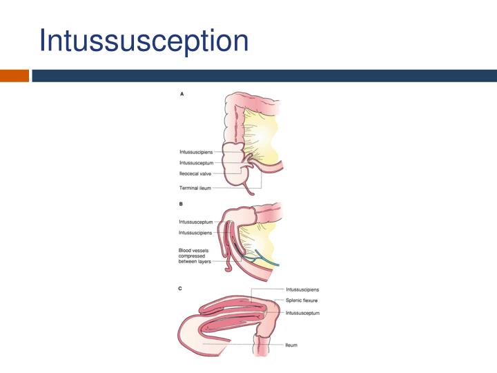 PPT - Acute surgical conditions PowerPoint Presentation - ID:2282683