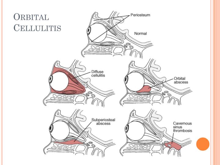 PPT - Anatomy of Head and Neck Infections PowerPoint Presentation - ID ...