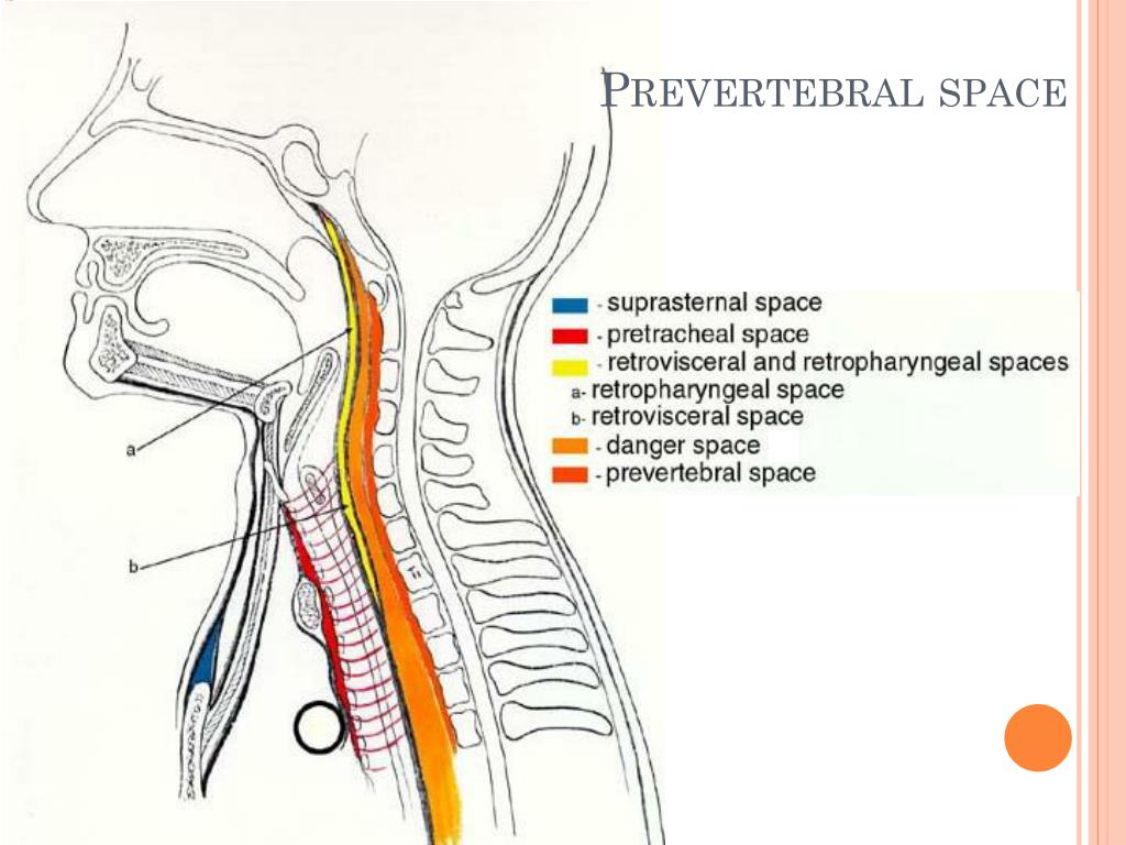 PPT - Anatomy of Head and Neck Infections PowerPoint Presentation, free ...