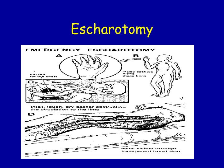 PPT - TRAUMA PowerPoint Presentation - ID:2282948