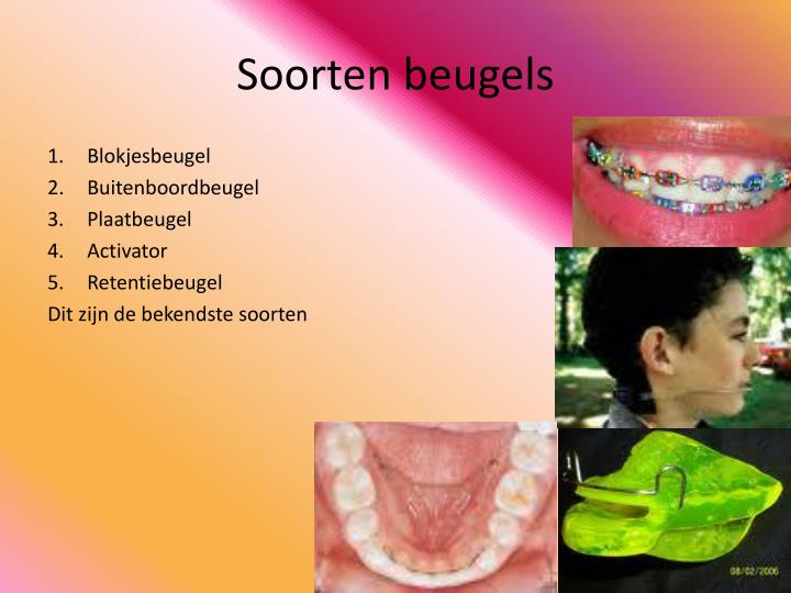 PPT - beugels PowerPoint Presentation - ID:2283463
