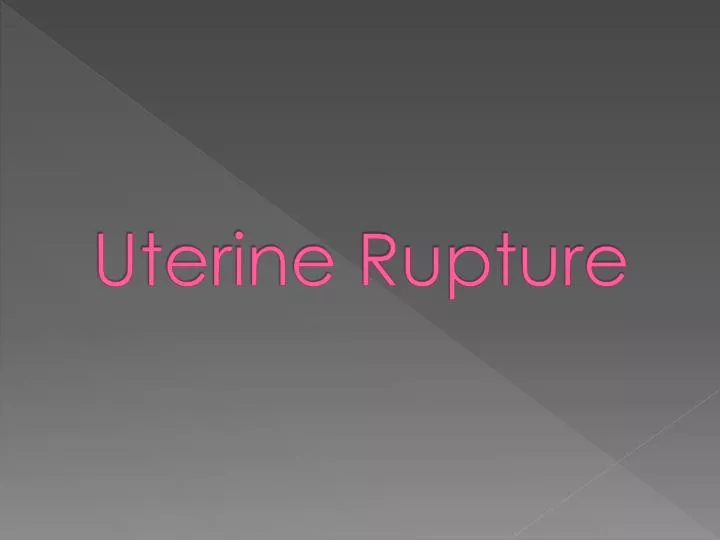 PPT - Uterine Rupture PowerPoint Presentation, free download - ID:2283868