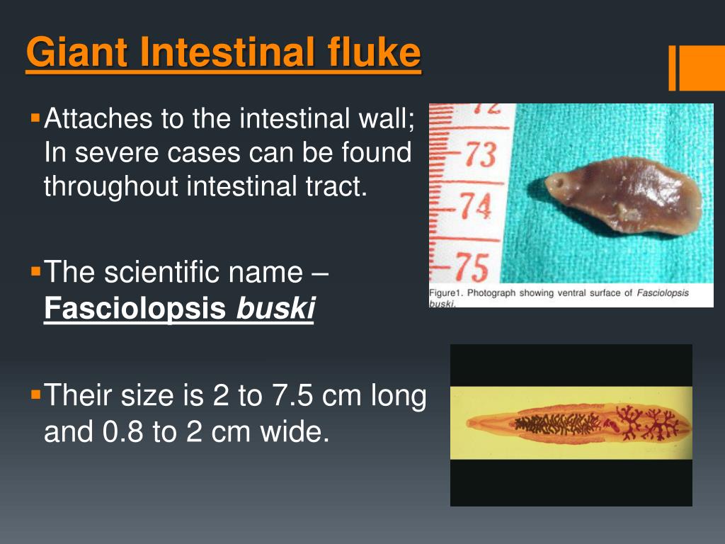 Symptoms Of Intestinal Flukes