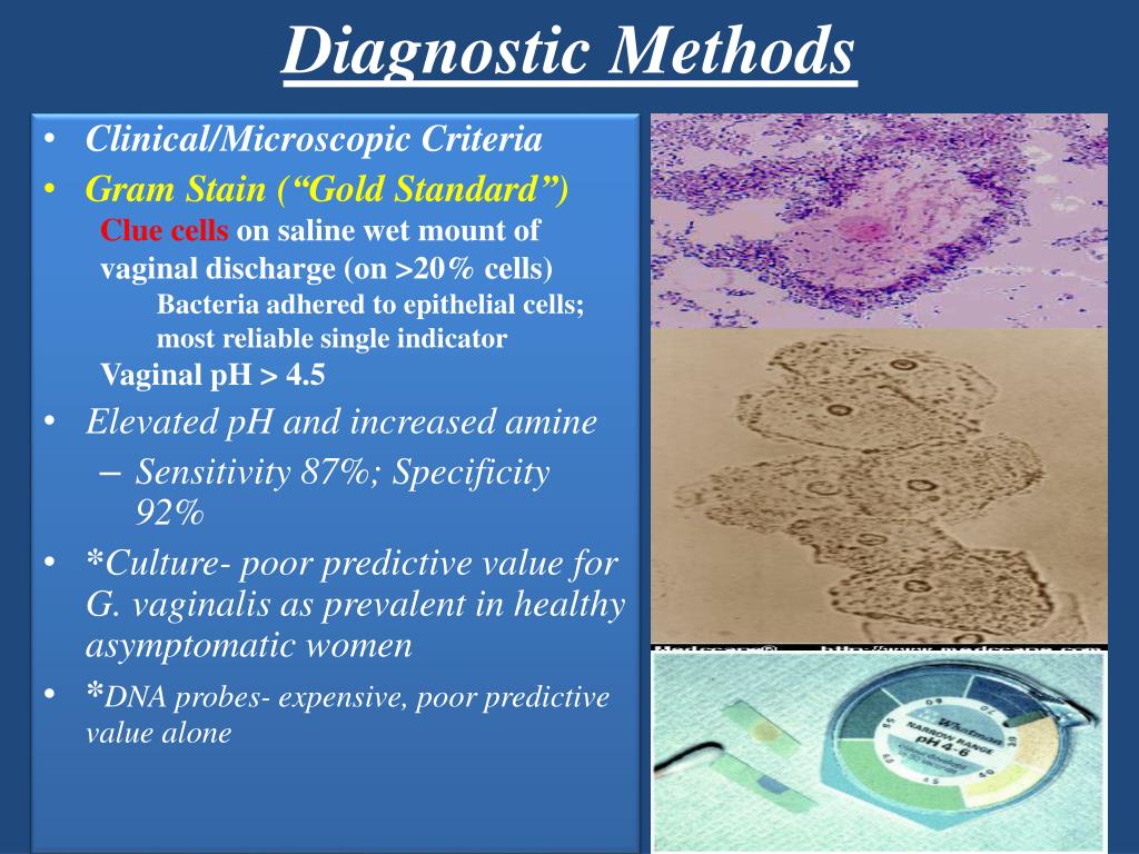 PPT - Candida infection T ricpmonas vaginalis Bacterial vaginosis ...