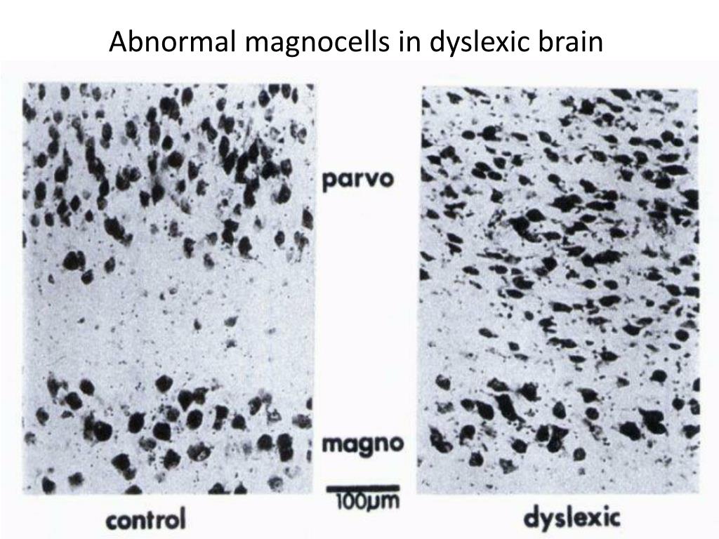 PPT - John Stein, Magdalen College, Oxford University, UK PowerPoint ...