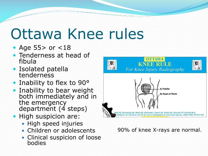 PPT - Derbyshire Sports Injuries Clinic presents PowerPoint ...