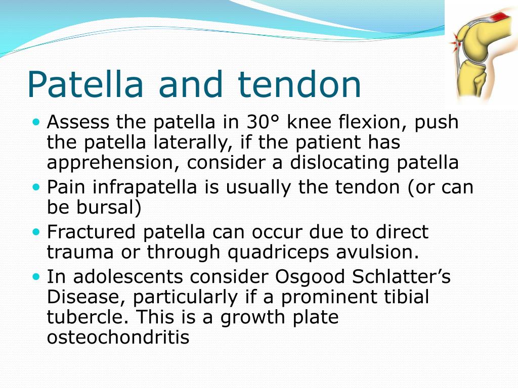 PPT - Derbyshire Sports Injuries Clinic presents PowerPoint ...