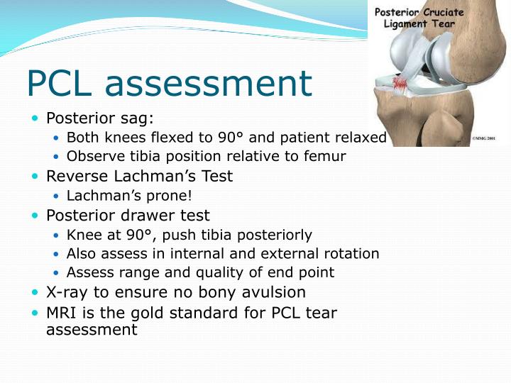PPT - Derbyshire Sports Injuries Clinic presents PowerPoint ...