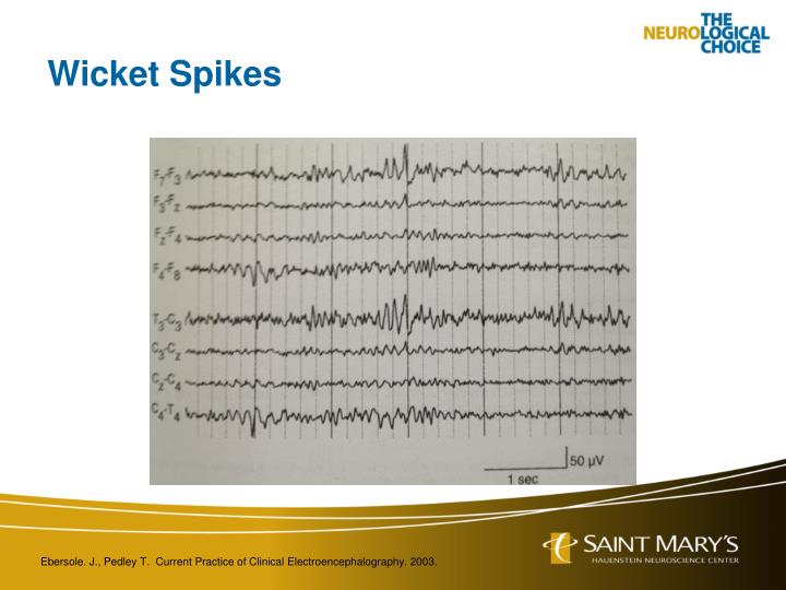 PPT - Benign EEG Variants And Patterns of Unknown Significance ...