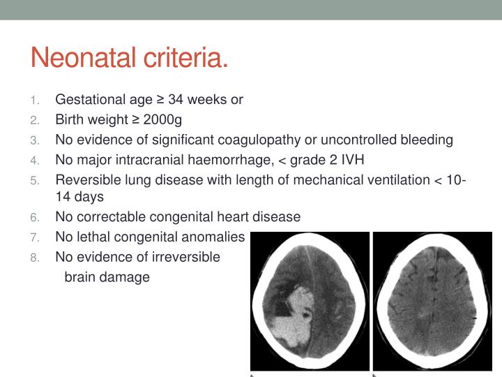 PPT - Cardiac ECMO PowerPoint Presentation - ID:2290904