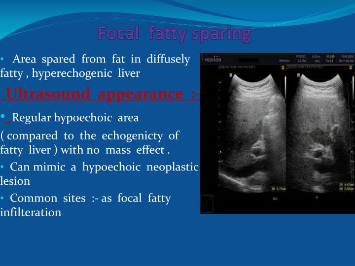 PPT - Abdominal ultrasound PowerPoint Presentation - ID:2291733