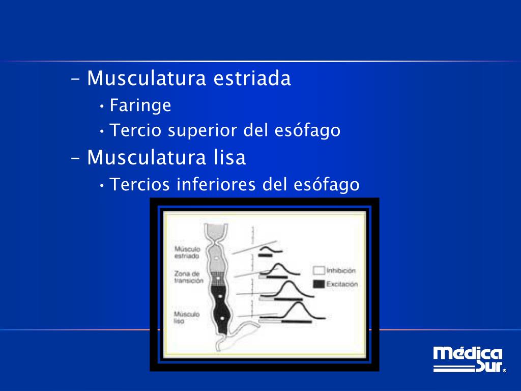 PPT - Trastornos de la motilidad esofágica PowerPoint Presentation ...