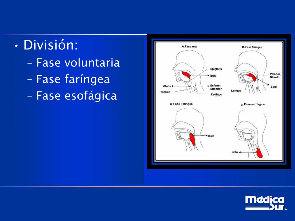 PPT - Trastornos de la motilidad esofágica PowerPoint Presentation ...