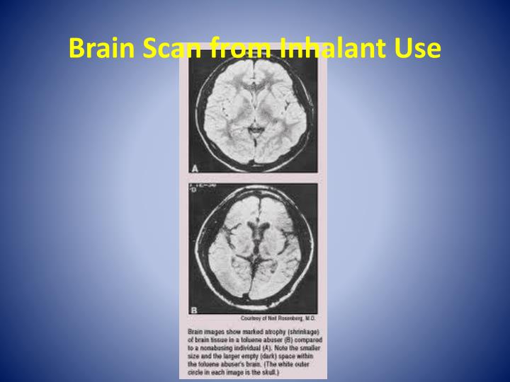 PPT - Inhalants PowerPoint Presentation - ID:2299365